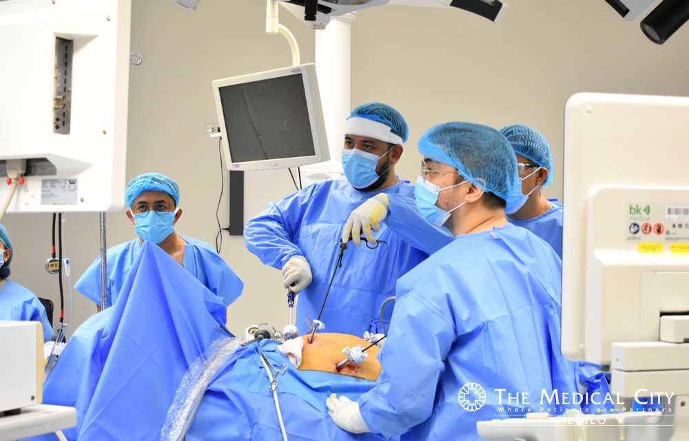 TMC Iloilo revolutionizes liver surgery, achieves another surgical ...